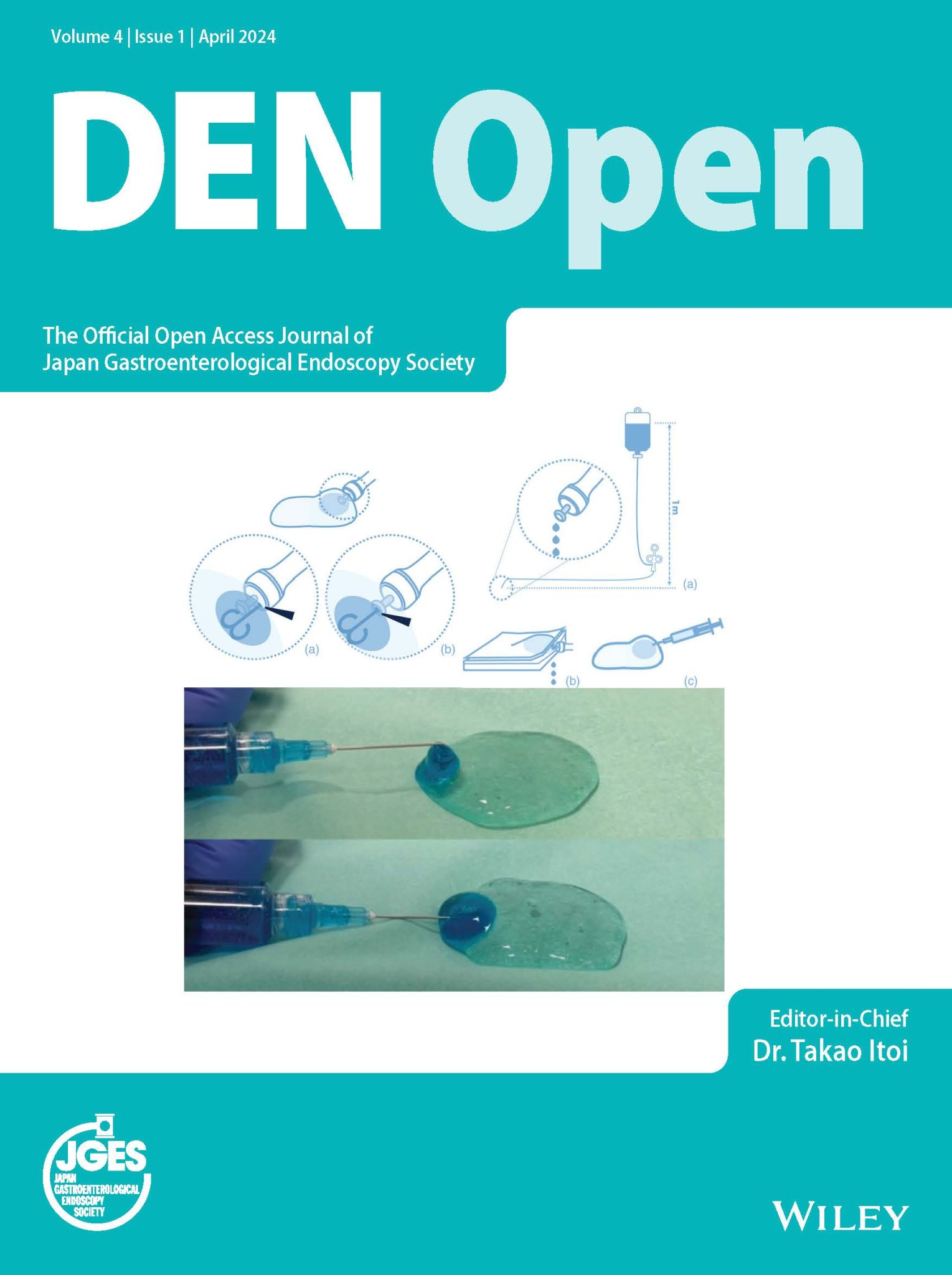 English Journal: DEN Open | Japan Gastroenterological Endoscopy Society